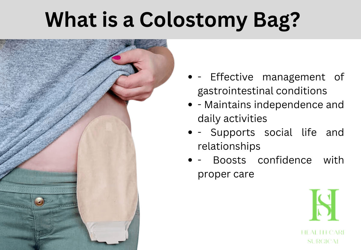 Living with a Colostomy Bag: A Comprehensive Guide
